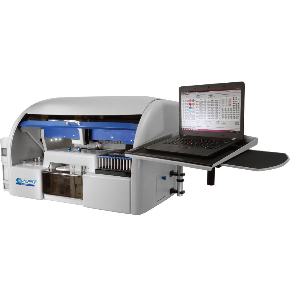 Monobind.com: Autoplex ELISA & CLIA Analyzer 3rd Gen